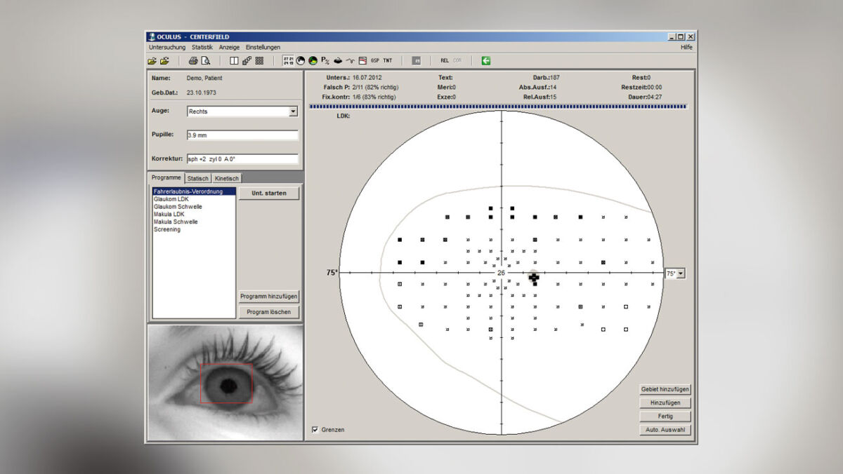OCULUS Centerfield® 2 - Gesichtsfeld-Messung bis 70° Exzentrizität ...