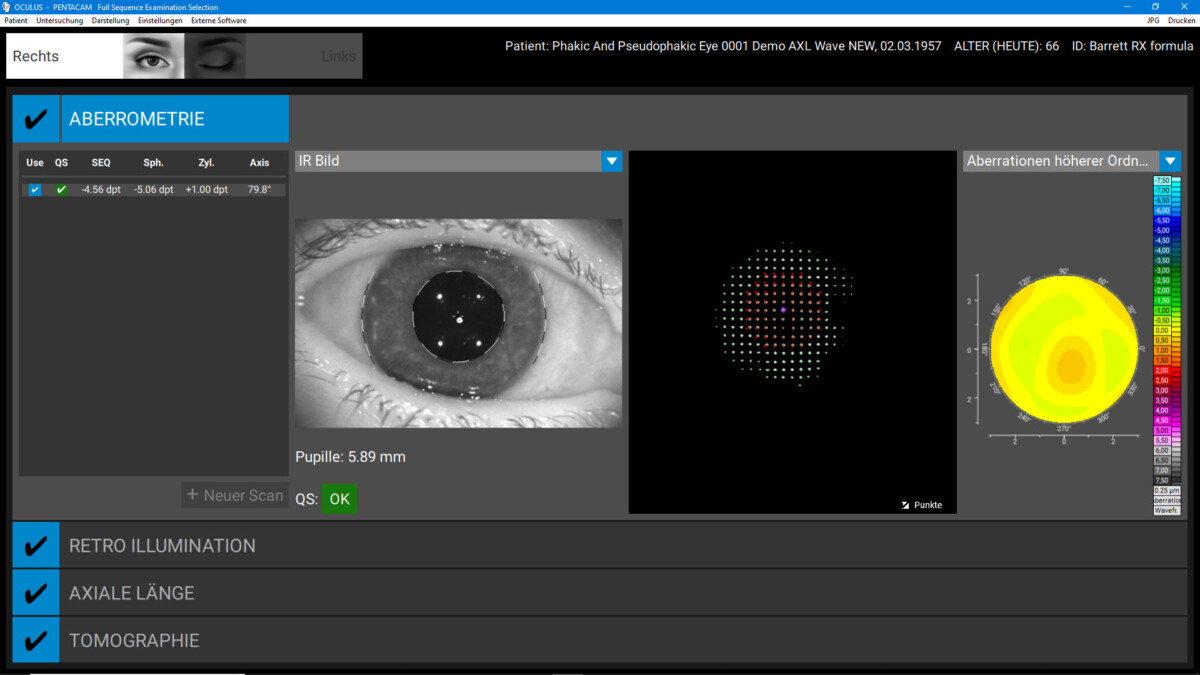 Pentacam® Familie | Software - OCULUS Optikgeräte GmbH